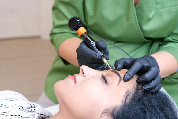 Best Micro needling Treatment in Burnaby | Orchid Skin Care